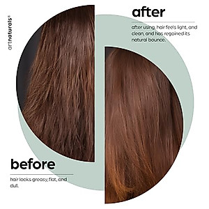 Artnaturals Tea Tree Shampoo - (16 Fl Oz / 473ml) - Sulfate Free – Made with 100% Pure Therapeutic Grade Tea Tree Essential Oil