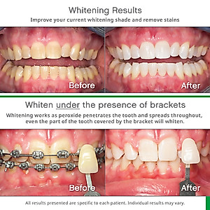 Opalescence GO 15% (10 Treatments) Original Prefilled Teeth Whitening Trays w/Travel Whitening Toothpaste 1.0 Oz. Hydrogen Peroxide - Cool Mint - Made by Ultradent.