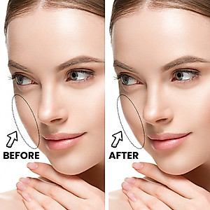 OPOVE Dermaplaning Tool Set,Professional Dermaplane Tools with 6 Refill Blades,Peach Fuzz Removal & Eyebrow Shaper–Face Shavers for Women,Facial Hair Razor Help Exfoliate and Smooth the Skin-Champagne