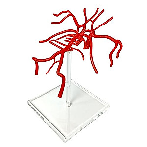 Evotech Brain Artery Model, Life Size Intracranial Artery Model, Shows Internal Carotid Artery, Willis Circle and Basillary Artery & Their Branches. On a Plexiglass Base