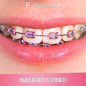 2080 Ligature Ties for Braces - Multicolor Dental Orthodontic Ligature Ties for Brackets - Elastic O-Ring Rubber Bands (2 Bags of 1040)