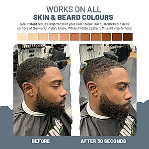 VOID Homme Beard Filling Pen Kit (Dark Brown, Set of 5) Beard Filler Pencil & Mens Beard Pen with Beard Brush, VOID Beard Filler Kit for Instant Beard Filling, Waterproof 48Hr VOID Beard Pen Kit