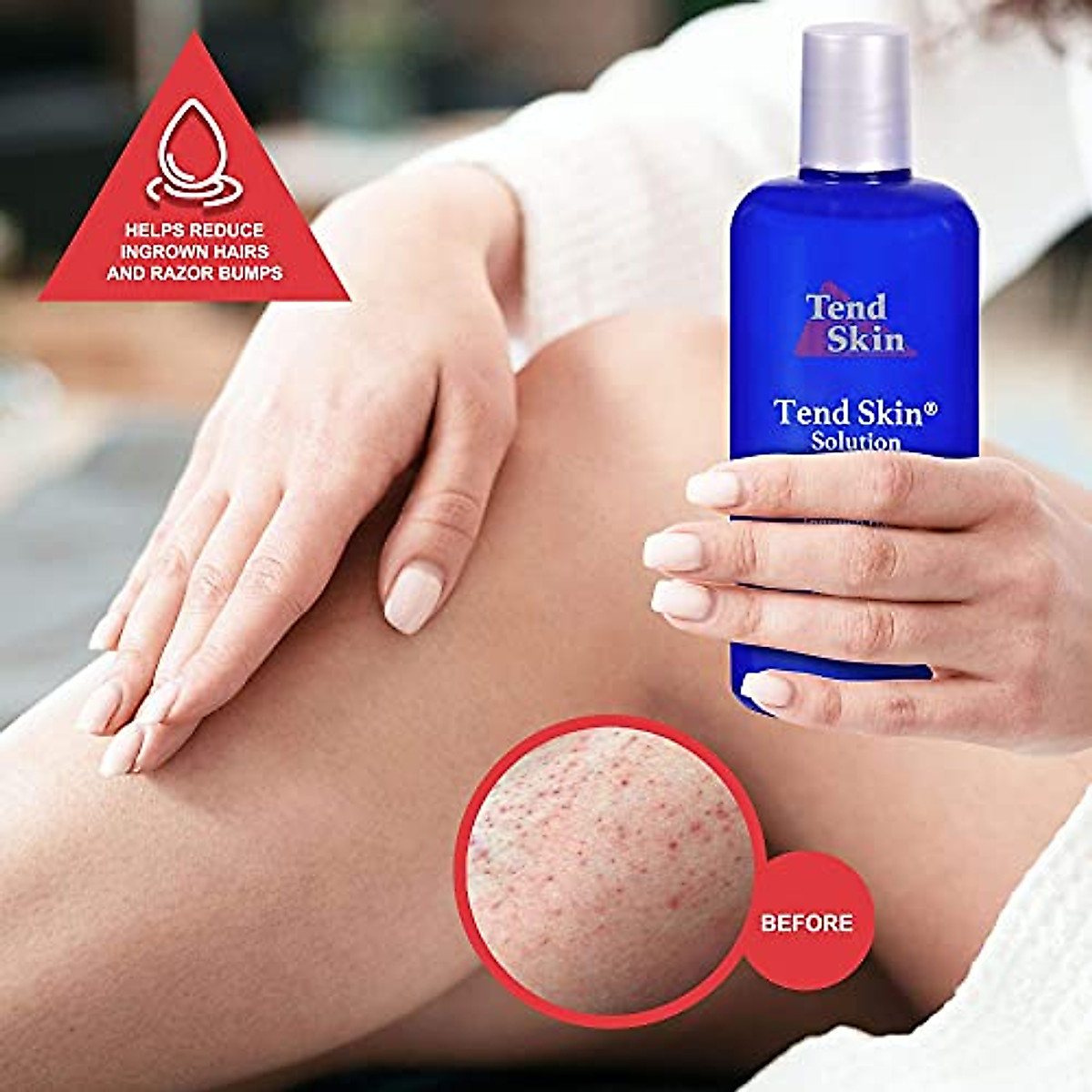 Tend Skin The Skin Care Solution For Unsightly Razor Bumps, Ingrown Hair And Razor Burns, 8 Fl Oz Bottle