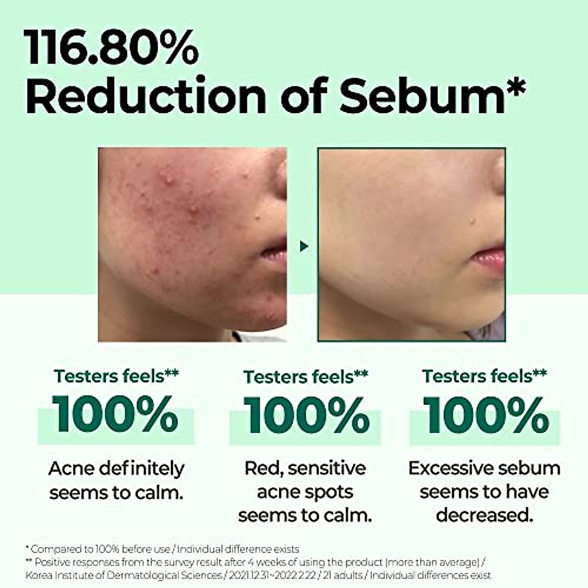 SOME BY MI AHA BHA PHA 30 Days Miracle Toner - 5.07Oz, 150ml - Made from Tea Tree Leaf Water for Sensitive Skin - Mild Exfoliating Daily Facial Toner - Acne, Sebum and Oiliness Care - Facial Skin Care