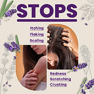 Candida Freedom Massey's Lavender Bliss Probiotic Soap Bar - Ideal Gift for a Spa-Like Experience - Perfect for Men & Women - Elevate Your Daily Wash with this Invigorating 4oz Bar