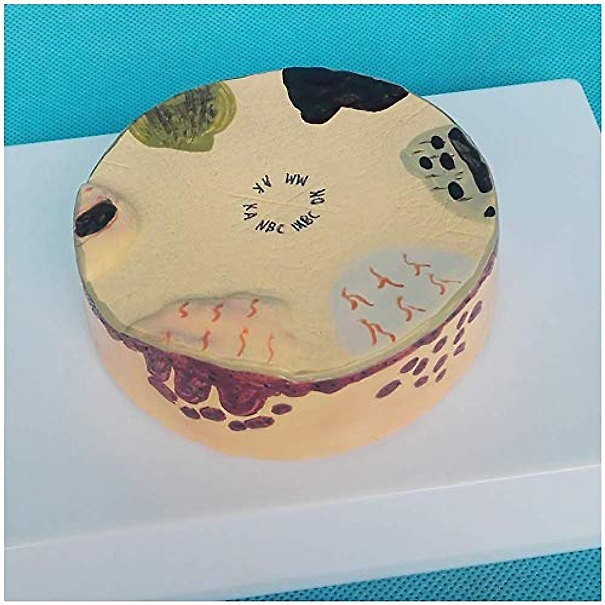 Anatomy Model Human Skin - Skin Enlarged Anatomy Model - Medical Anatomical Skin Structure Model Medical Teaching Model - for Medical Educational Aid