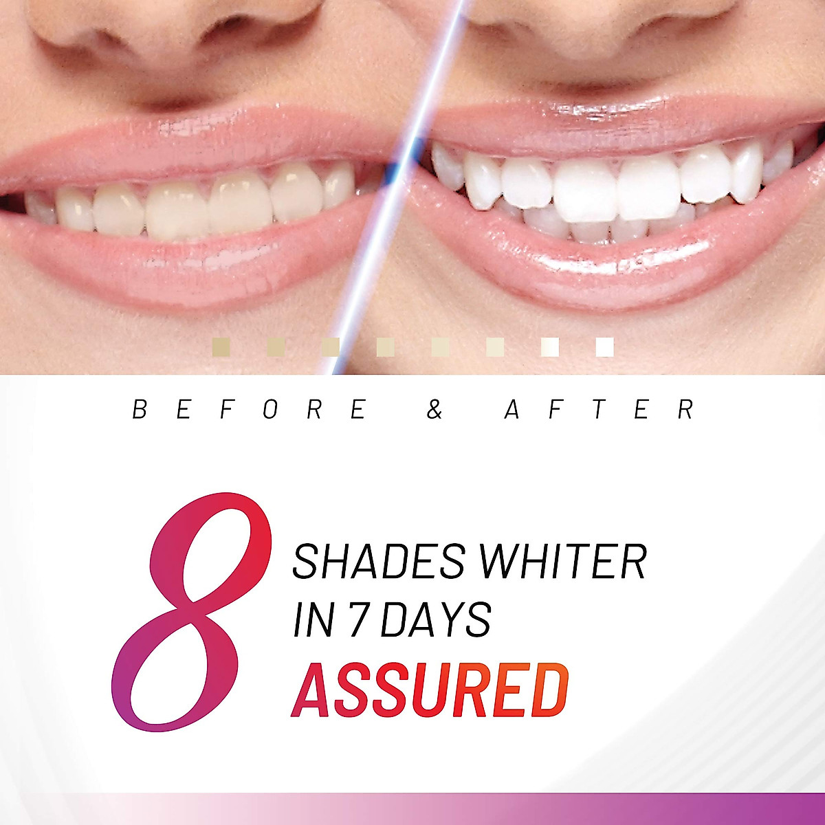 White Glo Accelerator Teeth Whitening Refill Gel for Sensitive Teeth and Gums, 3 Months of Professional Treatment, Carbamide Peroxide, Papaya, Pineapple Enzyme for Best Teeth Whitening Results - 3.4oz