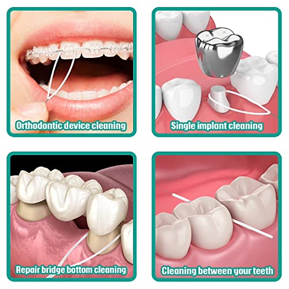 200 Pcs Floss Threaders for Bridges, 4 Packs Dental Floss for Braces, Bridges and Implants, Periodontal Disease Teeth Flossing