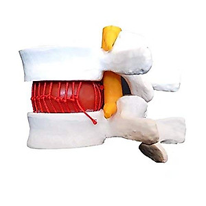 Doc.Royal Anatomical Human Lumbar Vertebrae Degenerative Lumbar Human Spine Model 1PCS