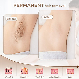 [FDA Cleared] IPL Hair Removal - LVARA Permanent Laser Hair Removal Device for Women Men - Painless At Home Hair Remover, 999,999 Flashes for Facial Bikini Legs Armpits