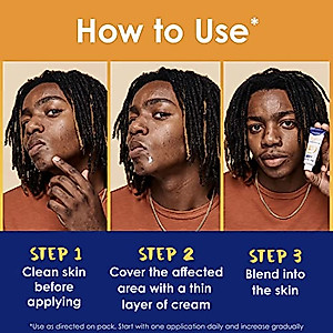 Clearasil Stubborn Acne Control 5-in-1 Spot Treatment Cream with Benzoyl Peroxide Acne Medication to Clear Acne, 1 Ounce (Pack of 3)