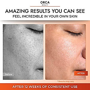 Vitamin C Serum For Face with Hyaluronic Acid Vitamin C Skin Serum Vitamin C Face Serum, Serum Vitamina C Para El Rostro Serum - Face Vitamin C Serum, Vitamin C Facial Serum, Vit C Serum