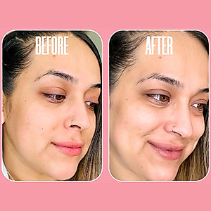 Glycolic Acid Pads with Vitamin C - Toner Pads for Face Cleansing With Tea Tree Oil - Exfoliating Pads with 20% AHA & Vitamins E, B3, B5 - Facial Peel Resurfacing Pads, Glycolic Acid Peel (50)