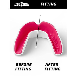 Legenda Sports Mouthguard for Kids (w/Case), Professional Mouthguard for Boxing, MMA, Karate, Football, BJJ, Martial Arts, Rugby, Lacrosse, Hockey (White/Pink)