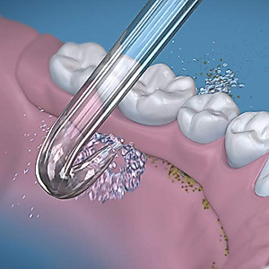 Waterpik DT-100E Implant Denture Replacement Tips Water Flosser Tip Replacement, Clear, 2 Count