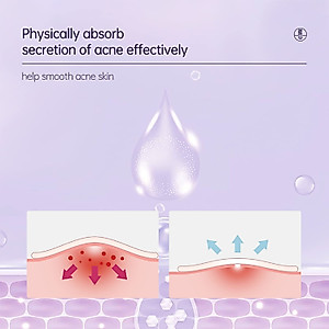 AVJONE Day and Night Hydrocolloid Acne Pimple Patch for Covering Zits and Blemishes, Spot Stickers for Face and Skin, Vegan - friendly and Not Tested on Animals (108+36 Patches)