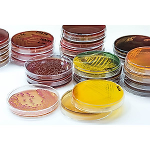 20 Pack Plastic Petri Dishes with Lids, 90 x 15mm Bioresearch Sterile Petri Dish, Culture Dishes for School Science Projects, Seeding, Storage, Biological Themed Party