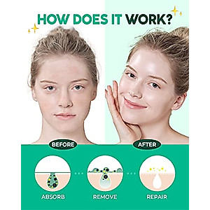 Glam Up - Calming Matcha Tea tree Clay Mask - Vegan Face Mask, Deep Cleansing, Calming Clay Mask for acne, Gentle Exfoliating Pore Purifying Skincare Face Mask, Acne Treatment, Blackhead remover - (125ml/4.23 Oz)