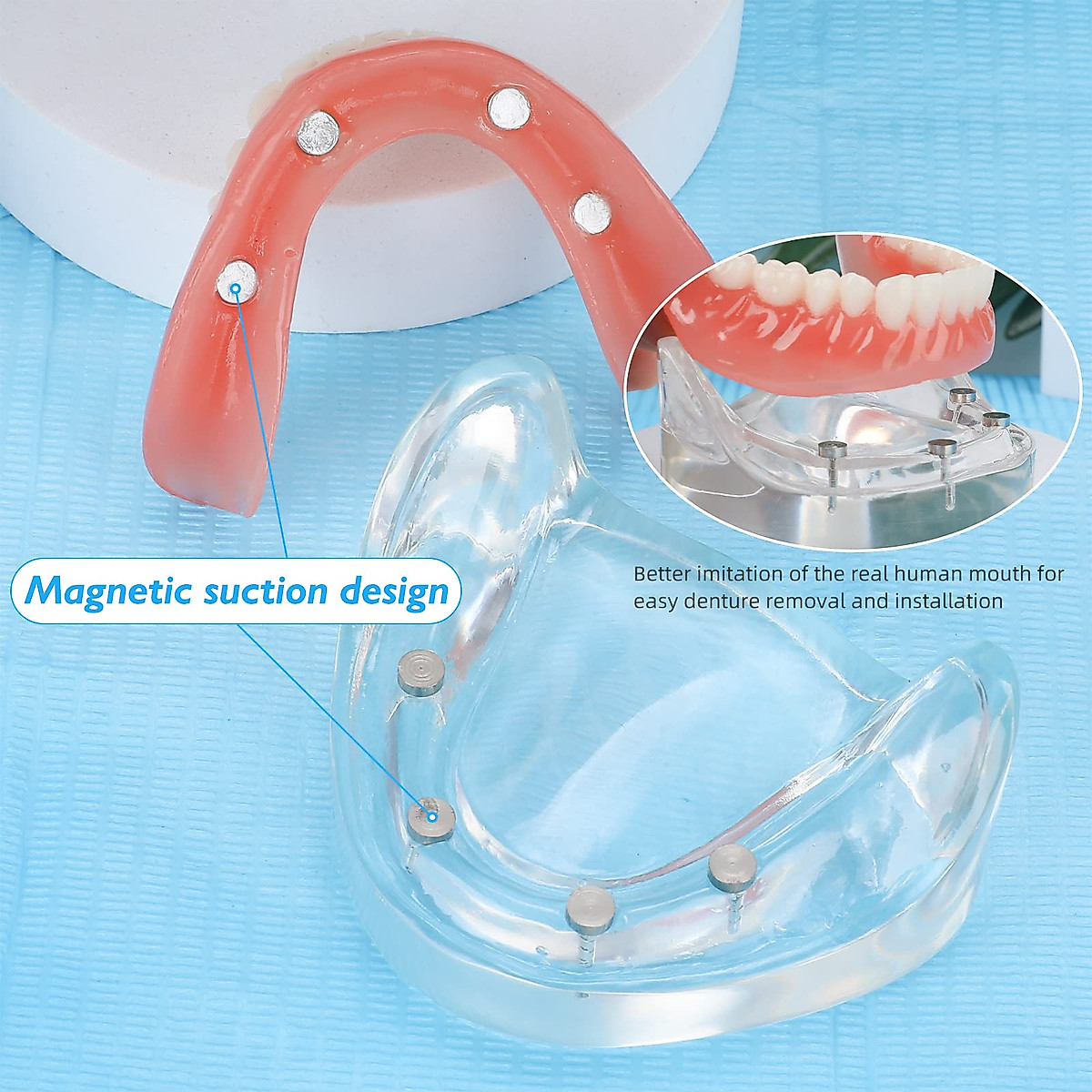 faruijie Overdenture Model - Implant Overdenture Model Lower Denture Model with Four Implants Dental Model Overdenture for Teaching and Studying