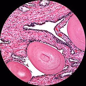 AmScope T490B Compound Trinocular Microscope, 40X-2000X Magnification, Halogen Light, Abbe Condenser, 2-Layer Mechanical Stage, High-Resolution Optics, Awarded No. 6 Among The Top 10 Microscopes 2016