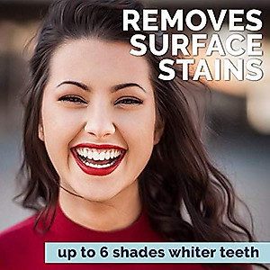 LUSTER Premium White Pro Sonic Dental Teeth Whitening System with Power Sonic Toothbrush