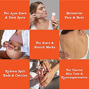 Bio-Oil Skincare Body Oil, Serum for Scars and Stretchmarks, Face and Body Moisturizer Dry Skin, Non-Greasy, Dermatologist Recommended, Non-Comedogenic, For All Skin Types, with Vitamin A, E, 4.2 oz