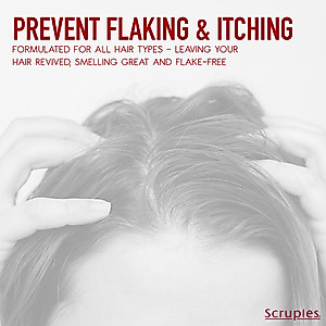 Scruples Clearet Anti Dandruff Shampoo - Professional Deodorizing Shampoo to Soothe Dry & Itchy Scalp From Flaking - Scalp Treatment + Cleanser (8.5 oz)