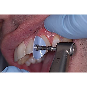 BELEON Dental Abrasive Discs with Metal Connector - Dental Kit for Polishing Sanding Finishing Grinding - Tooth Polish Disc - Set100pcs Discs + Mandrel