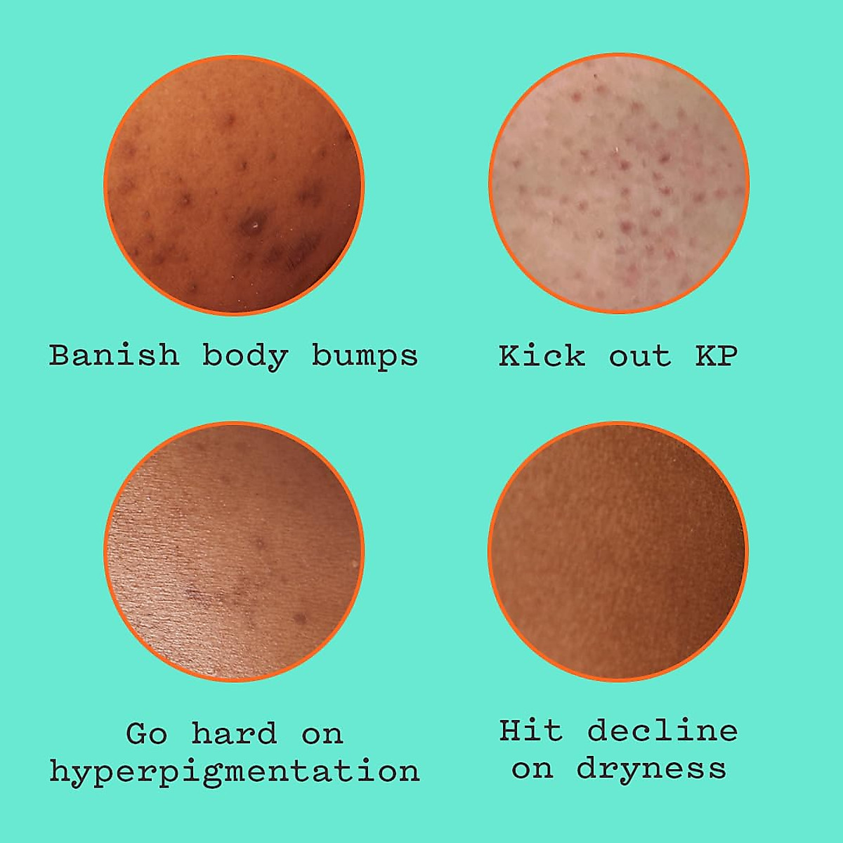 frank Body Glycolic Body Scrub | Vegan, Cruelty Free, Exfoliating Body Scrub | Helps to Fight Breakouts and Soothes Skin & Marks with AHA, Pumice, Witch Hazel, and Niacinamide | 8.82 oz / 250 g