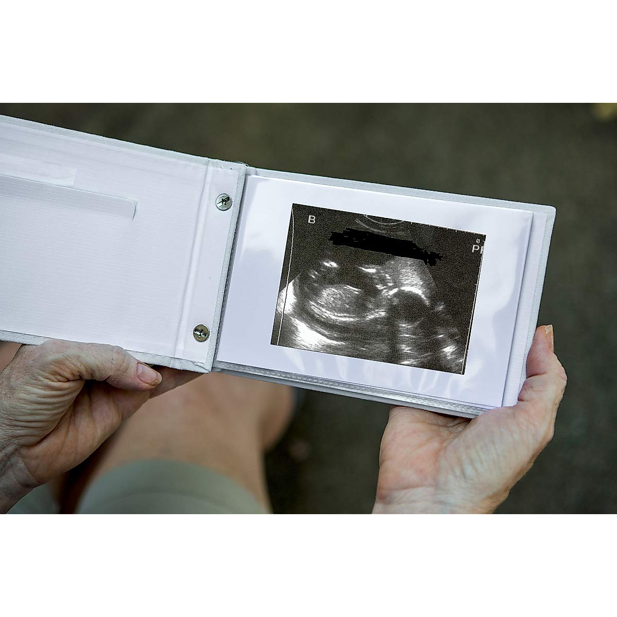Pregnancy/Maternity Ultrasound And Photo Album/Keepsake