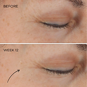 Elizabeth Arden Retinol Ceramide Capsules Line Erasing Night Serum, Anti-Aging Serum for Fine Lines and Wrinkles, Suitable for All Skin Types, 30 pc, 0.47 fl oz