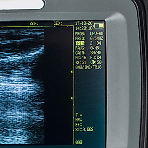 Veterinary Ultrasound Scanner HandScan V8 for Pregnancy Digital Veterinary Ultrasonic Scanner Machine with Convex Probe for Farm Animals Pet - US New Version