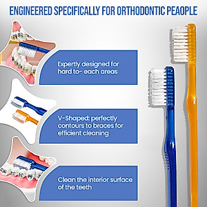 AIM DENTAL SUPPLY Toothbrush for Braces, Soft Head Braces Toothbrush, V Trimmed Design 2-Pack | Quick Orthodontic Cleaning | Deep Clean Braces at Home (Pack of 2)