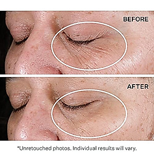 StriVectin High-Potency Wrinkle Filler, 0.5 Fl Oz