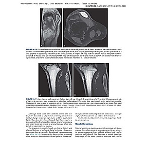 Musculoskeletal Imaging: Expert Radiology Series