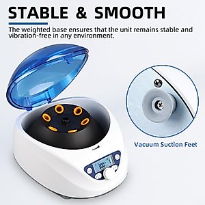 NORJIN PRP Lab Benchtop Centrifuge Machine 6x15mL/10mL/7mL/1.5-5mL, Low Speed Control 300-5000r/min, Max. 2600xg RCF for Lab School Science Plasma Research