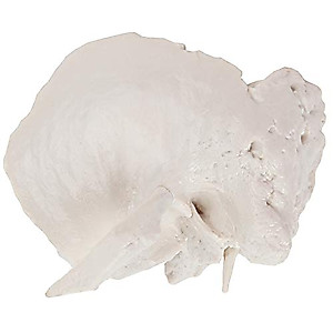 Axis Scientific Temporal Bone - Left