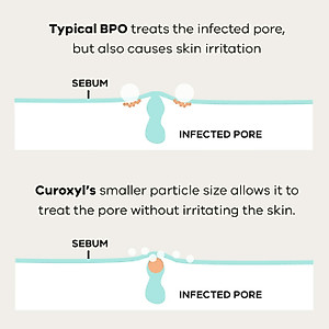 BPT10 Acne Treatment Moisturizer | 10% Benzoyl Peroxide 1% Tea Tree Oil | 55% Organic 89% Natural | Gentle Plant-based Vegan & Cruelty-free | 2.2 fl. oz