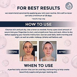 Peptide Collagen Serum for Face - Anti-Aging Facial Serum, Tighten Lift Hydrate & Plump All Skin Types, Reduce Fine Line & Wrinkles, All Natural Ingredients - Foxbrim Naturals (1 Fl Oz)