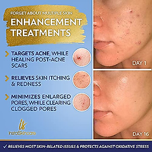 DOUBLE SIZED (2Oz) Niacinamide Serum for Face 10% with Zinc 1% Vitamin B3 Facial Serum Brightening Serum for Acne Pore Minimizer and Dark Spot Remover