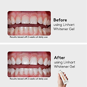 LINHART Teeth Whitening Kit with LED Light - Tooth Whitener Gel, Dental Whitening Gel Syringes with 35% Carbamide Peroxide and 16-Led Whitening Light - No Sensitivity, Whitens Teeth