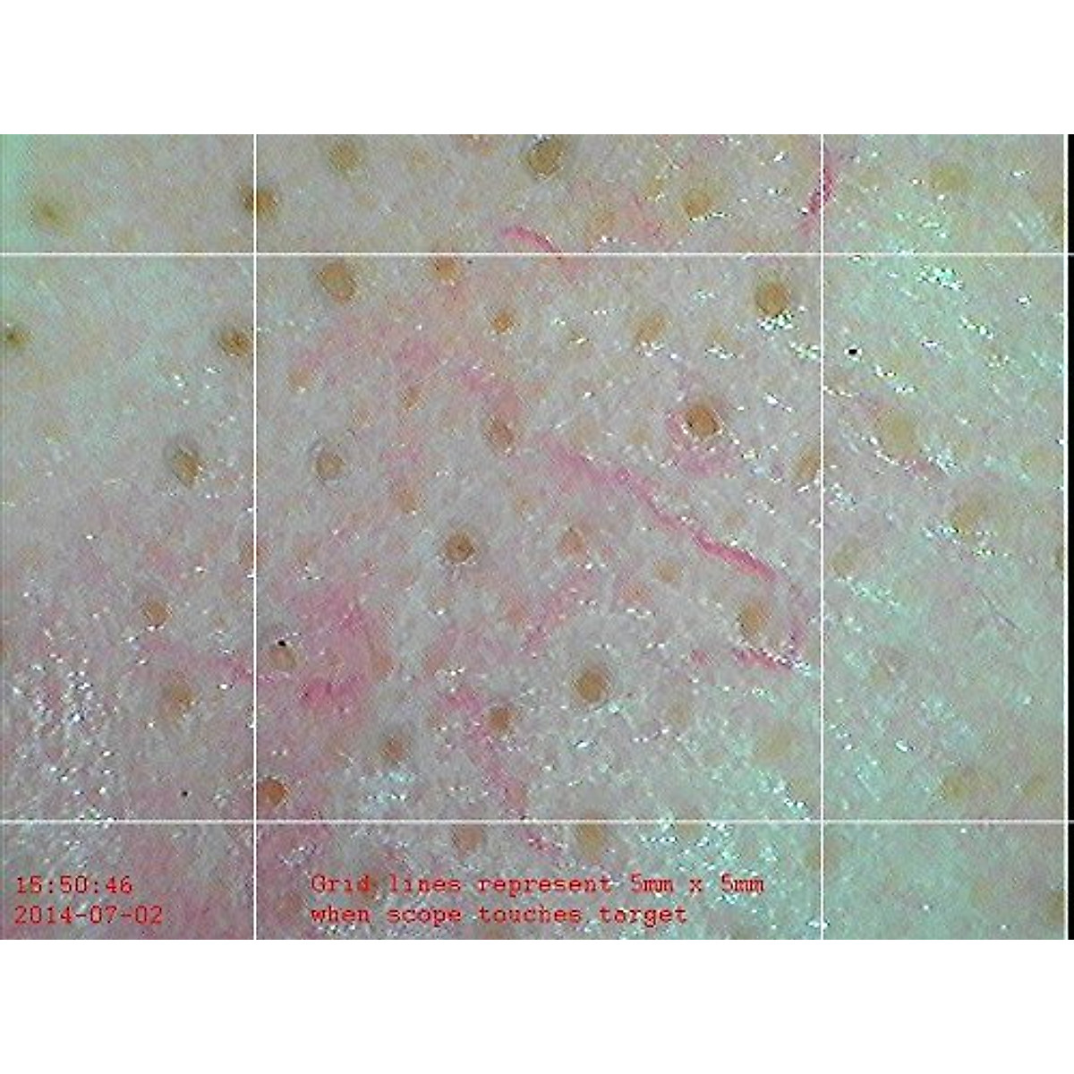 Firefly DE350 Wireless Polarizing Dermatoscope