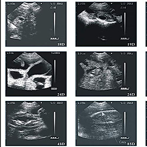 MLSJM Ultrasound Scanner,Pig Veterinary Ultrasound Scanner Machine Kit,Veterinary Farm Animals for Pig Pregnancy, Rechargeable Smart B-Ultrasound Handscan