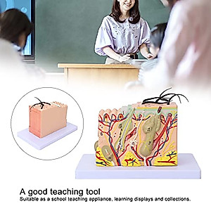 Skin Model 35X Enlarged Anatomical Skin Model 3 Dimensional Skin Teaching Aids Model for Skin Cosmetology Study Display Teaching Model