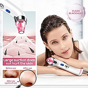 Blackhead remover pore vacuum, Facial Pore Cleaner, Electric Acne Comedone Whitehead Extractor Tool with 5 suction power, 4 probes, Blackhead Remover Suction for Women & Men (Pink)