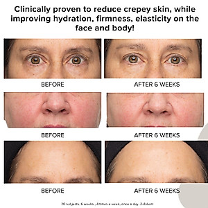 Priori Skincare 2xfoliant Peel + Scrub for Face and Body Lactic Acid Retinol Vitamin C, E At-Home Microdermabrasion Anti-Irritant Dermatologist Tested 6.8 fl oz