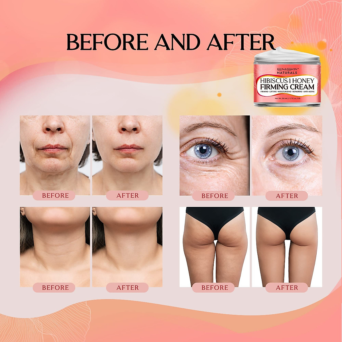 Enaskin Naturals B Flat Belly Firming Cream For Women: Best Skin Tightening Cream with Hibiscus and Honey - 100ML