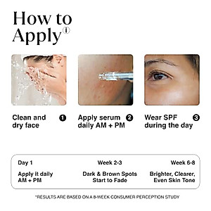 MATKAS Korean Dark Spot Remover for Face & Body Serum + Niacinamide + Oat Extract for Deep Correcting Uneven Skin Tone, Brightening Hyperpigmentation Treatment, Dark Spot Corrector Lightening Cream