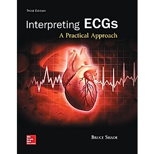 Interpreting ECGs: A Practical Approach