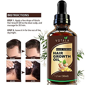 Hair Growth Serum, VOTALA Hair Growth Treatment, Anti Hair Loss, Promotes Thicker, Stronger Hair, And Hair Regrowth for Men Women